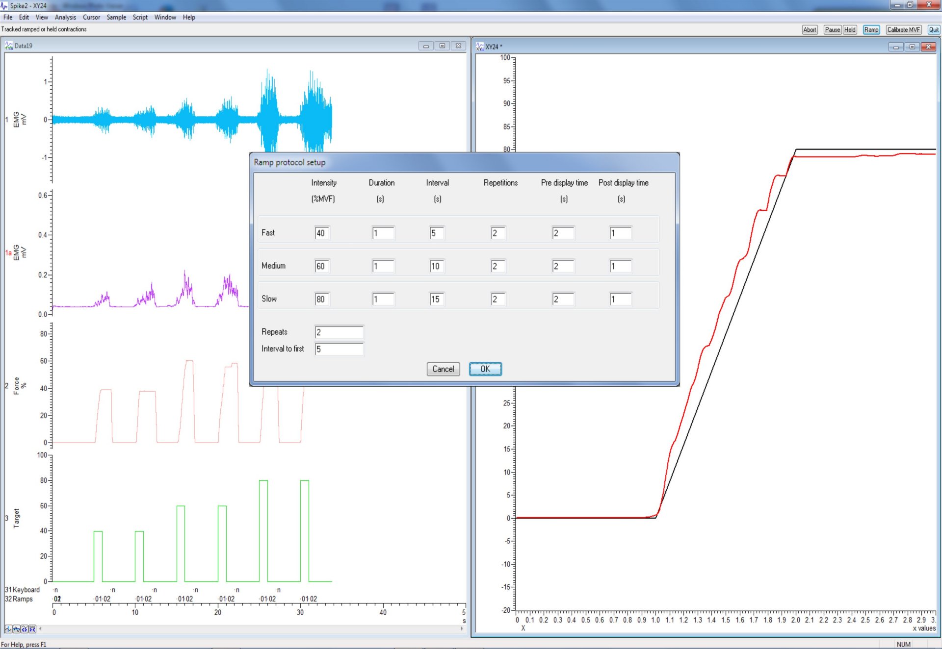 CED Spike2: Features