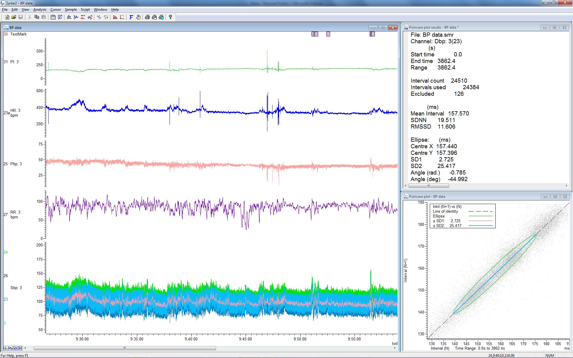 CED Spike2: Data acquisition